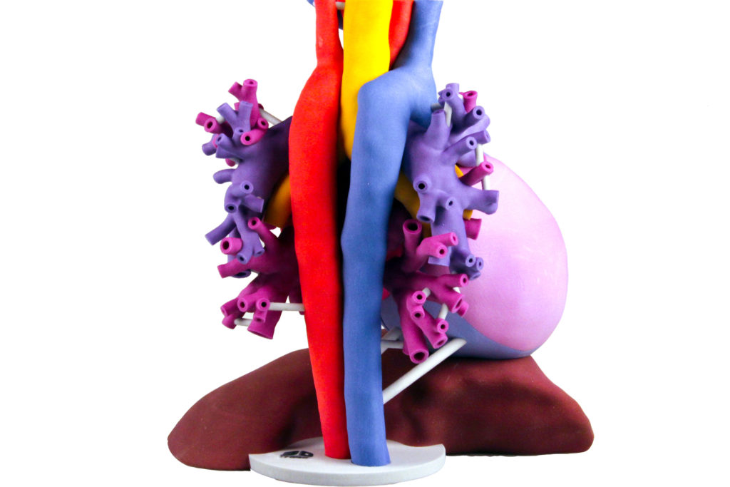 Sophisticated 3D modeling plays growing role in healthcare - Health ...