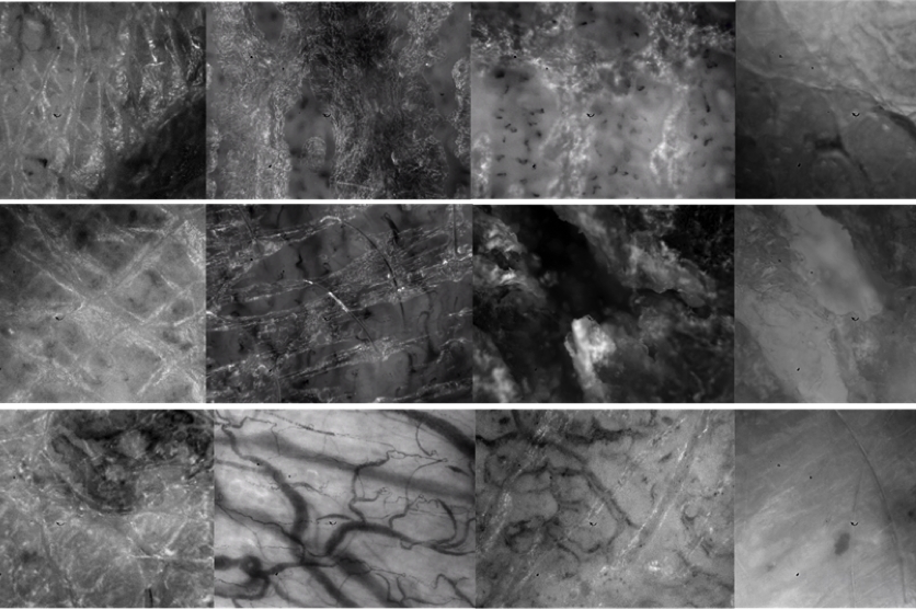 Algorithms ‘unbend light’ to help new camera see through skin - Health ...