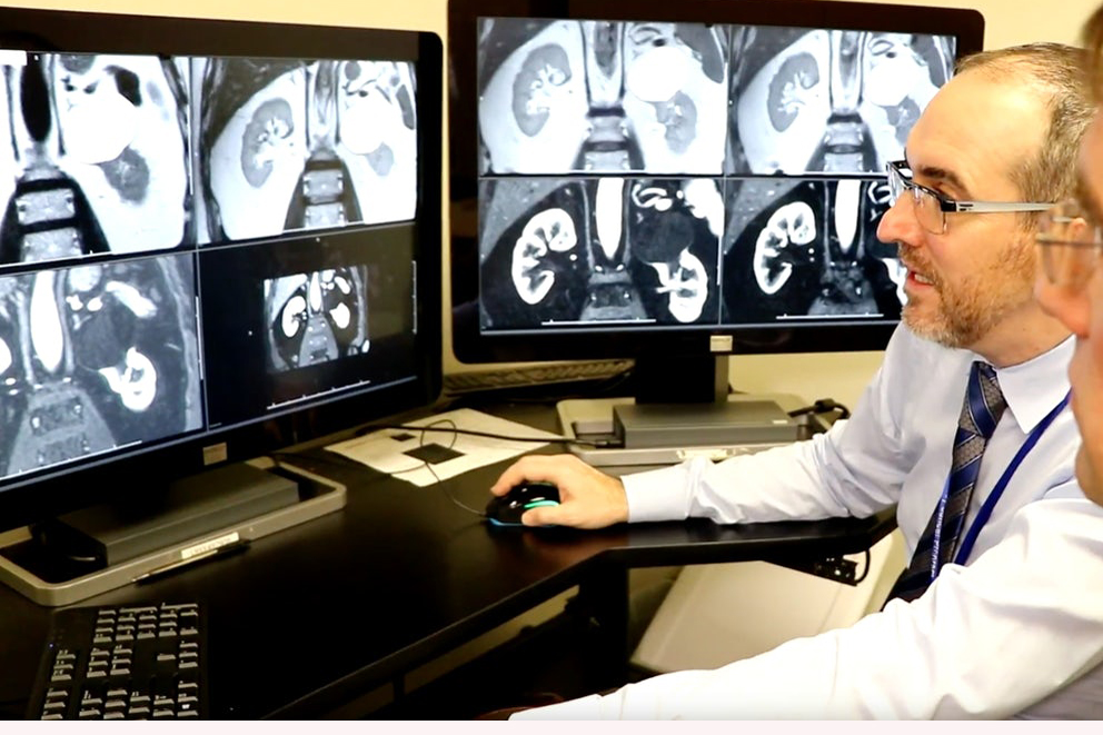 Algorithm, MRI images eliminate need for kidney cancer biopsies ...
