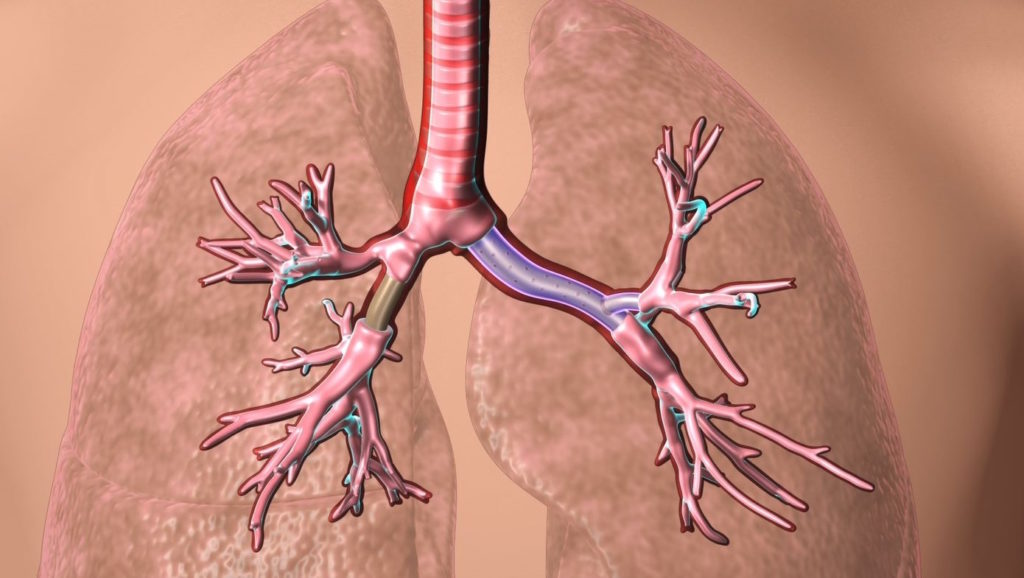FDA clears 3D-printed airway stents tailored to patient anatomy ...