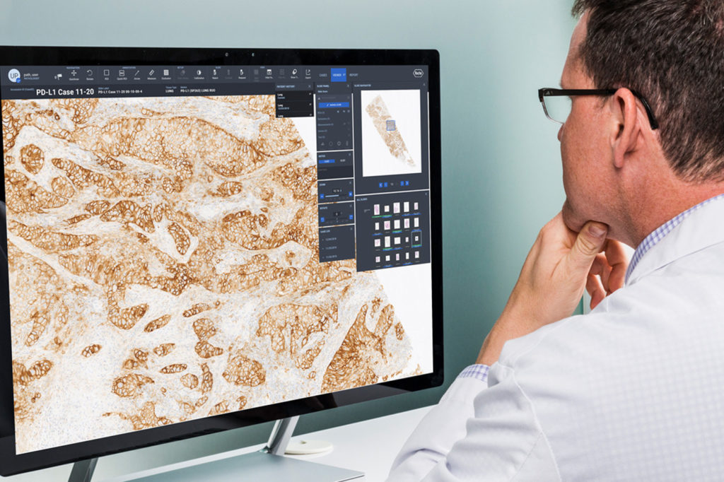 Roche releases enterprise platform for pathology images - Health Data ...