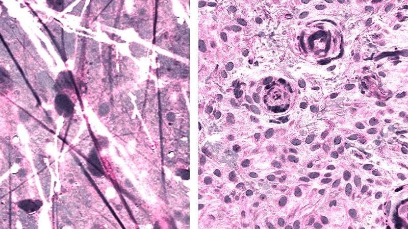 Ai Imaging System Able To Accurately Identify Brain Tumors Health